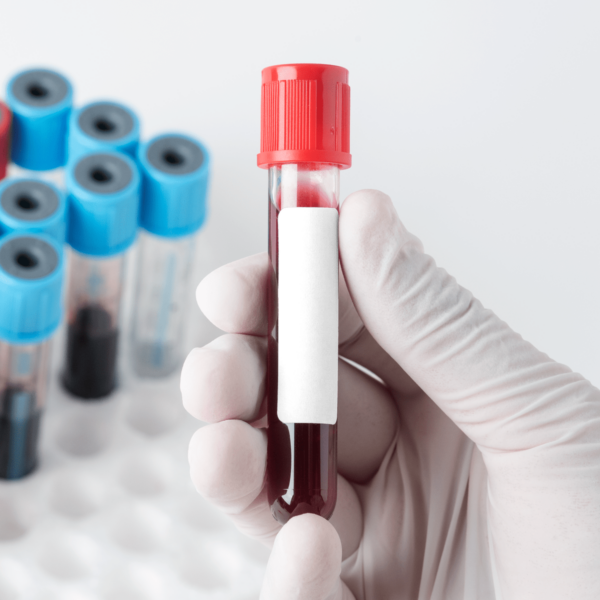 Specialized Blood Testing Montville, NJ - Invest in my Health Corp